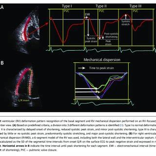 Echocardiographic Deformation Imaging Of The RV Download Scientific Diagram