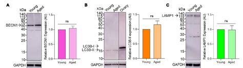 Figure 4 From The Impact Of Aging On Macroautophagy In The Pre Ovulatory Mouse Oocyte Semantic