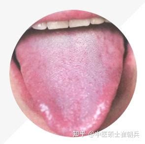 史上最全舌诊图谱！【珍藏版】 知乎