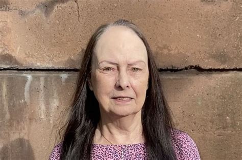 Balding Man Goes On Month Long Sex Ban For Hair Growth And Totally