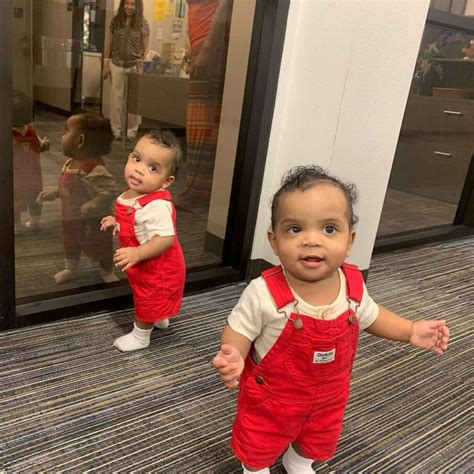 Formerly Conjoined Twin Sisters Turn 1 Take First Steps In Major