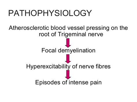 Trigeminal Neuralgia