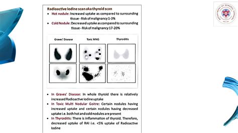 Benign Thyroid Diseases Hypothyroidism And Hyperthyroidism Graves