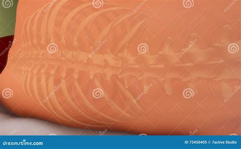 Spinal Anaesthesia Stock Illustration Illustration Of Catheter 73450405