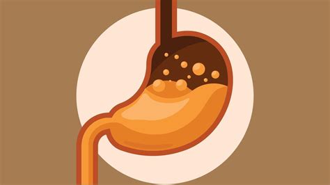 Human Organ Stomach In Process Of Digestion Of Food Illustration