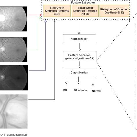 Block Diagram Of The Proposed Retinal Computer Aided Diagnosis System Download Scientific Diagram