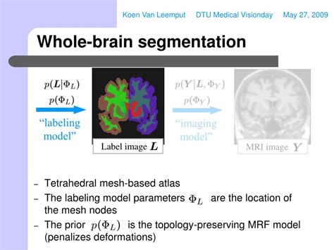 PPT Generative Models For Automated Brain MRI Segmentation PowerPoint Presentation ID