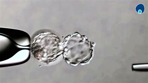 Diagnostic Génétique Préimplantatoire Dgp Barcelona Ivf