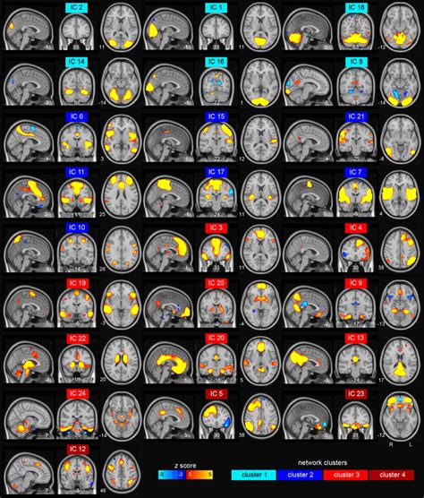 Resting State Networks Identified Through Group Ica Results From Download Scientific Diagram