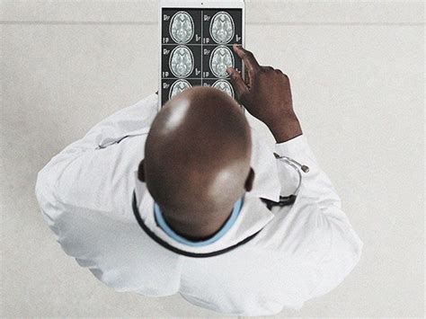 Late Onset Multiple Sclerosis Loms Symptoms Causes And Treatments