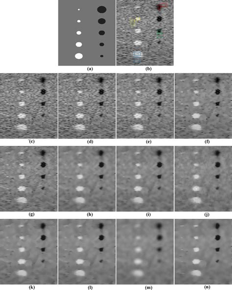 visual comparison of restoration performance of various despeckling