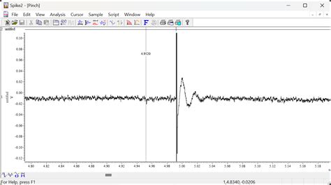 Electrophysiology Confusing Artifact In An Electrically Stimulated Compound Action Potential