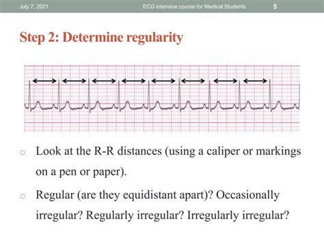 Ecg Basics Lecture 4 PPT
