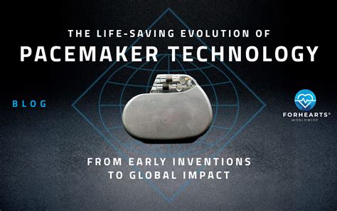 The Life Saving Evolution Of Pacemaker Technology