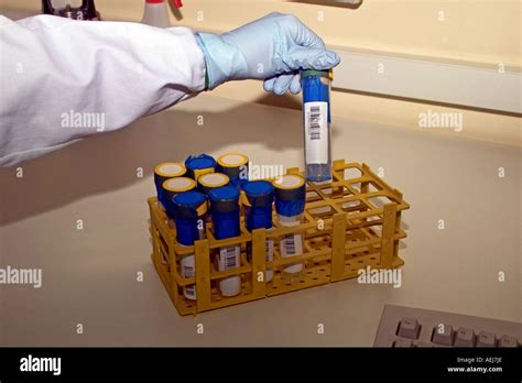 Files Of Human Bone Samples For Dna Identification International