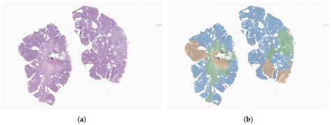 Example Of A Wsi A With Manual Segmentations Overlayed B Tissue