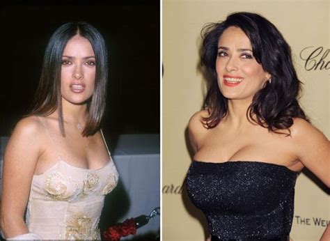 Salma Hayek Plastic Surgery Before And After Pictures Bellezza Del Viso