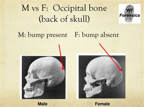 Occipital Protuberance Male Vs Female 63 The Skull Medicine