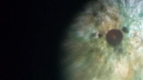 Variety Of Pollen Grains And How To Talk About What I Saw Without Knowing Technical Words