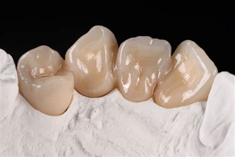 Priti®multidisc Zro2 Multi Translucent Pritidenta