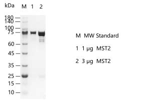 MST2 STE Kinase ICE Bioscience Protein Platform