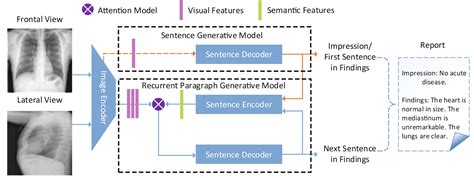 论文笔记 Multimodal Recurrent Model With Attention For Automated Radiology Report Generation 知乎