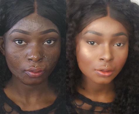 Camouflage Makeup For Severe Skin Discolorations — Make Up First®