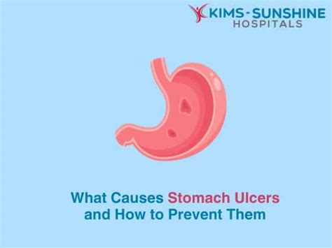 What Causes Stomach Ulcers And How To Prevent Them