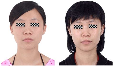 a typical result of deduplication application a pair of duplicated