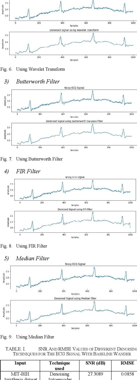 Figure 1 From Ecg Denoising Using Multiple Approaches Semantic Scholar