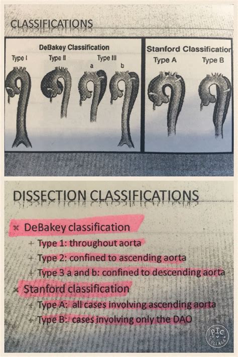 Irad Aortic Dissection Classification Terymaniac