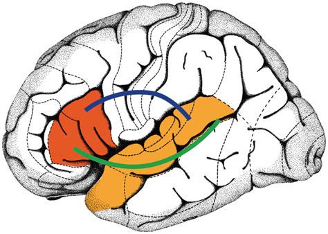 language is the function of this part of the brain