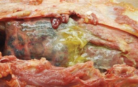 Fibrinous Exudate Definition And Examples Biology Online Dictionary