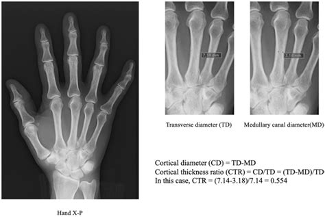 Calculation Of CTR The Calculation Procedure For CTR Is Shown The Download Scientific Diagram