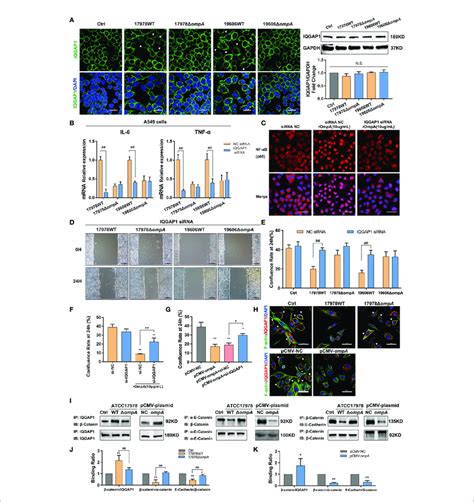 Ompa Dependent Inflammatory Regulation And Cytoskeletoncell Junction
