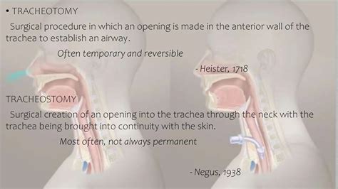 Tracheostomy Seminar For Oral And Maxillofacial Surgery Postgraduates