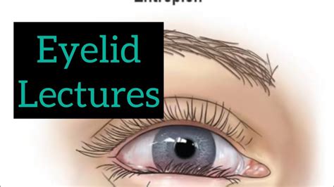 Eyelid Lectures Part 4blephritis Eyelectures Eyelid Jatoi