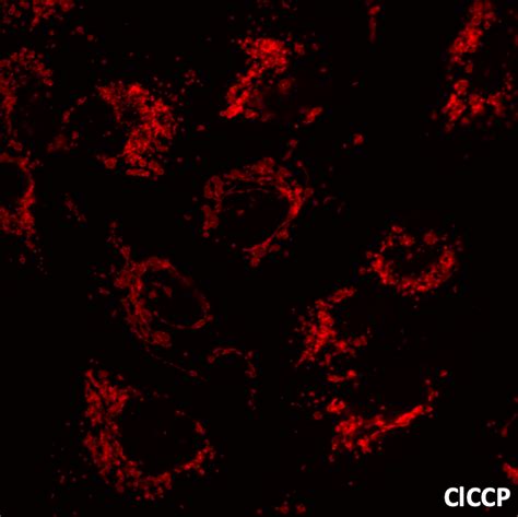 Mitochondrial Integrity And Dynamics Mitologics
