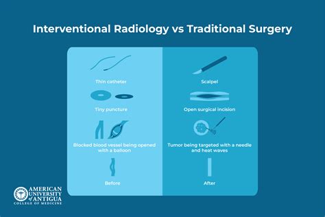 What Is Interventional Radiology Procedures And Treatments
