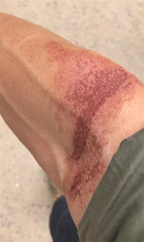 Vincent Ng The Role Of Health Insurance In His Life Of Action Health