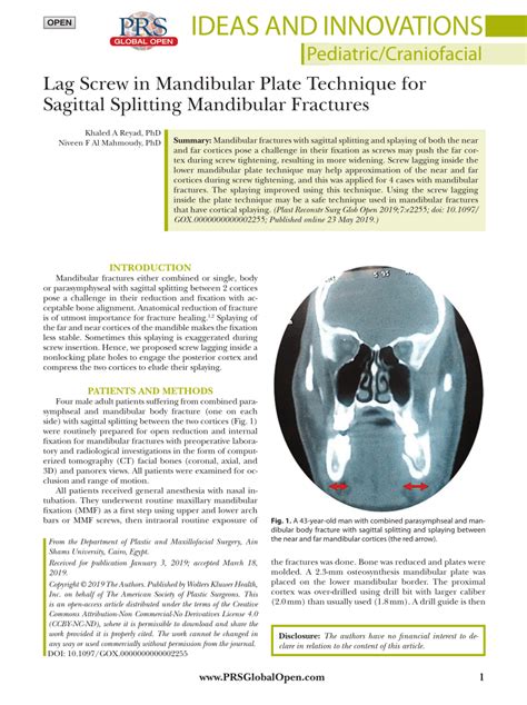 Pdf Lag Screw In Mandibular Plate Technique For Sagittal Splitting