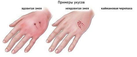 Нет руки- нет проблемы | Пикабу