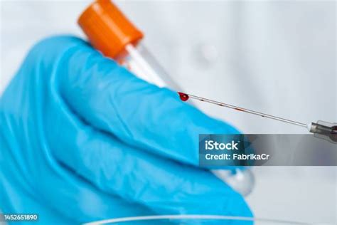 파란색 장갑을 낀 의사가 혈액과 주사기로 손 테스트 튜브를 유지합니다 손에 대한 스톡 사진 및 기타 이미지 손 주사기 피