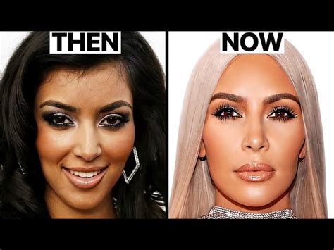 Kim Kardashian Plastic Surgery Before And After