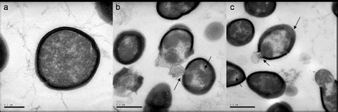 Transmission Electron Micrographs Of E Faecalis 20000x A Control
