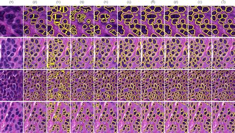 The Comparative Segmentation Results On Four Representative Image Download Scientific Diagram