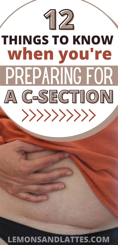Scheduled C Section Artofit