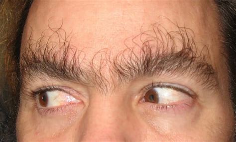 What Causes Random Long Eyebrow Hair
