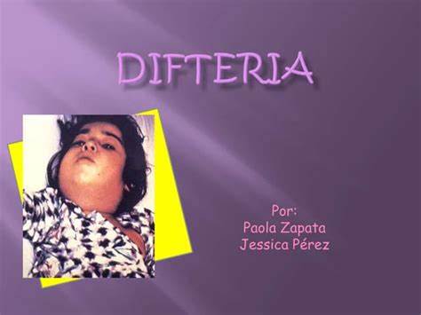 Difteria Diapo Pptx