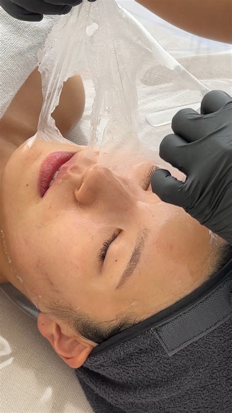 당진피부관리 예산피부관리 서산피부관리 엘루엔에스테틱 윤영원장🤍 색소지우개 멜라리티 최초 런칭 비침습적 고주파 기술로